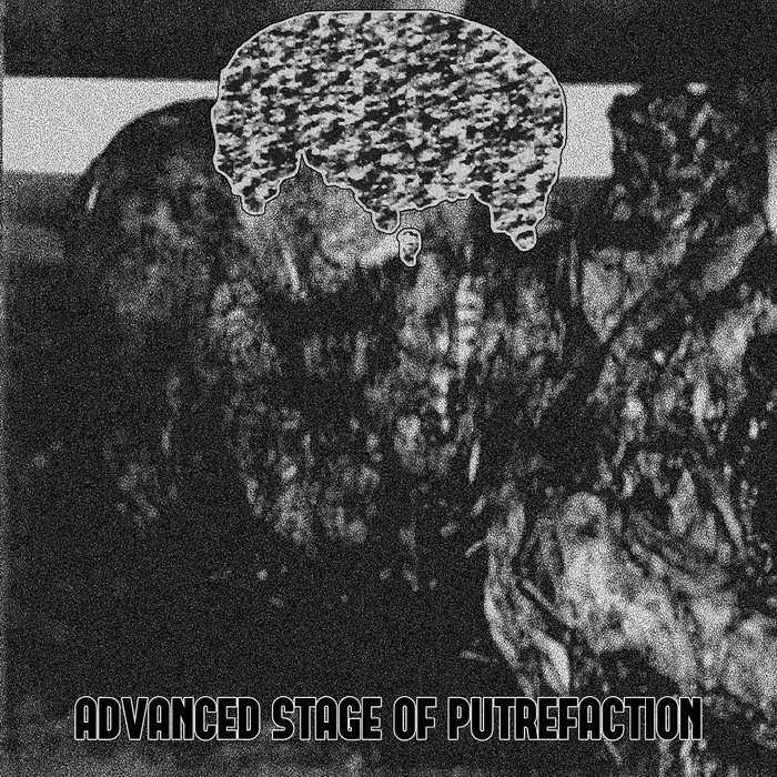 Advanced Stage of Putrefaction | Septic Cadaver