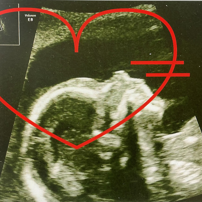 Ditt hjärta | Thomas Teller