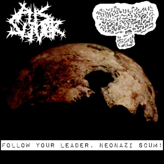 Pus Sliver & Carcinoma Basocelular - Follow Your Leader, Neo Nazi Scum ...