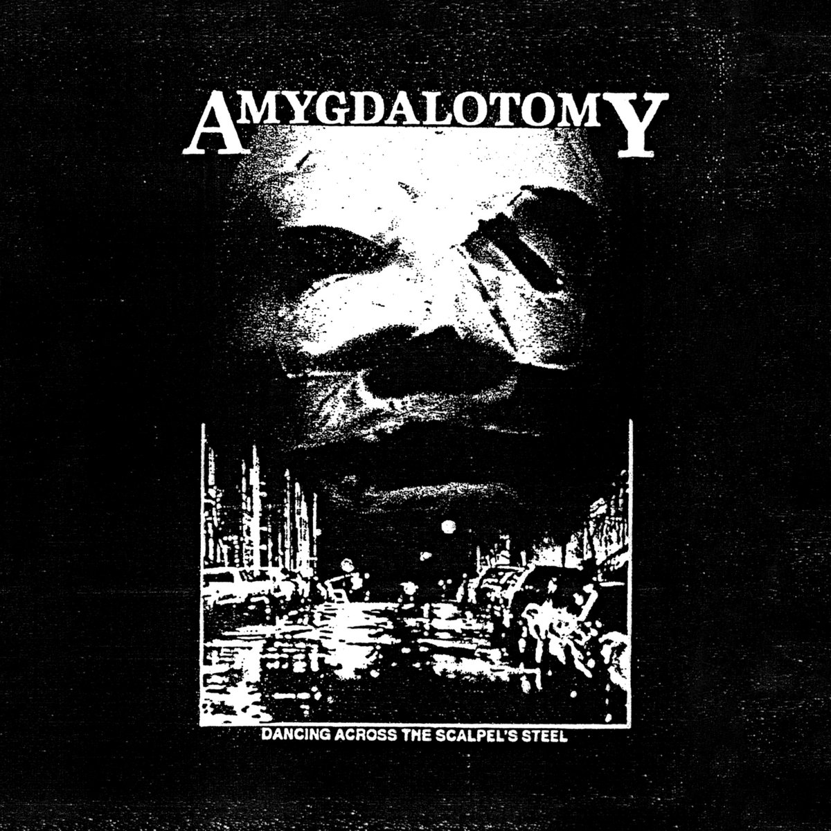 Dancing Across The Scalpel's Steel | Amygdalotomy | Hospital Productions