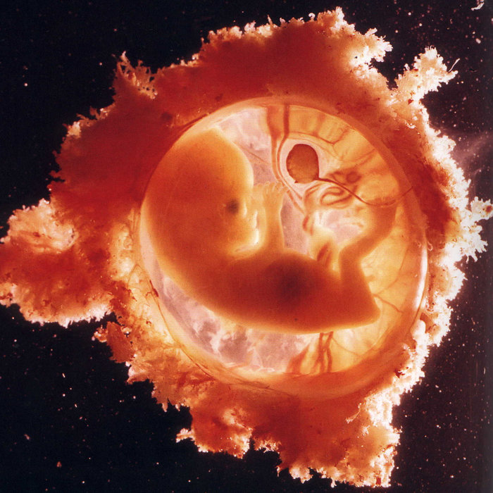 Gravid Thought Vol 2. | Levi Bradis. Casey Sebby. Kevin Sloma. | Levi ...