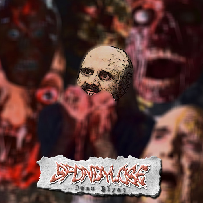 Demo Blyat | Spondylosys | CULTUS