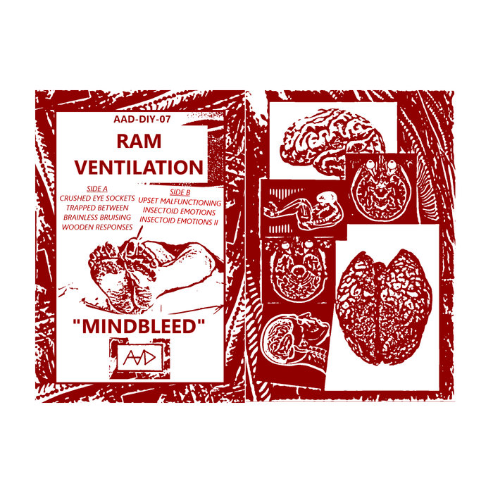 AAD-DIY-07: RAM VENTILATION "Mindbleed" Side B: Upset Malfunctioning ...