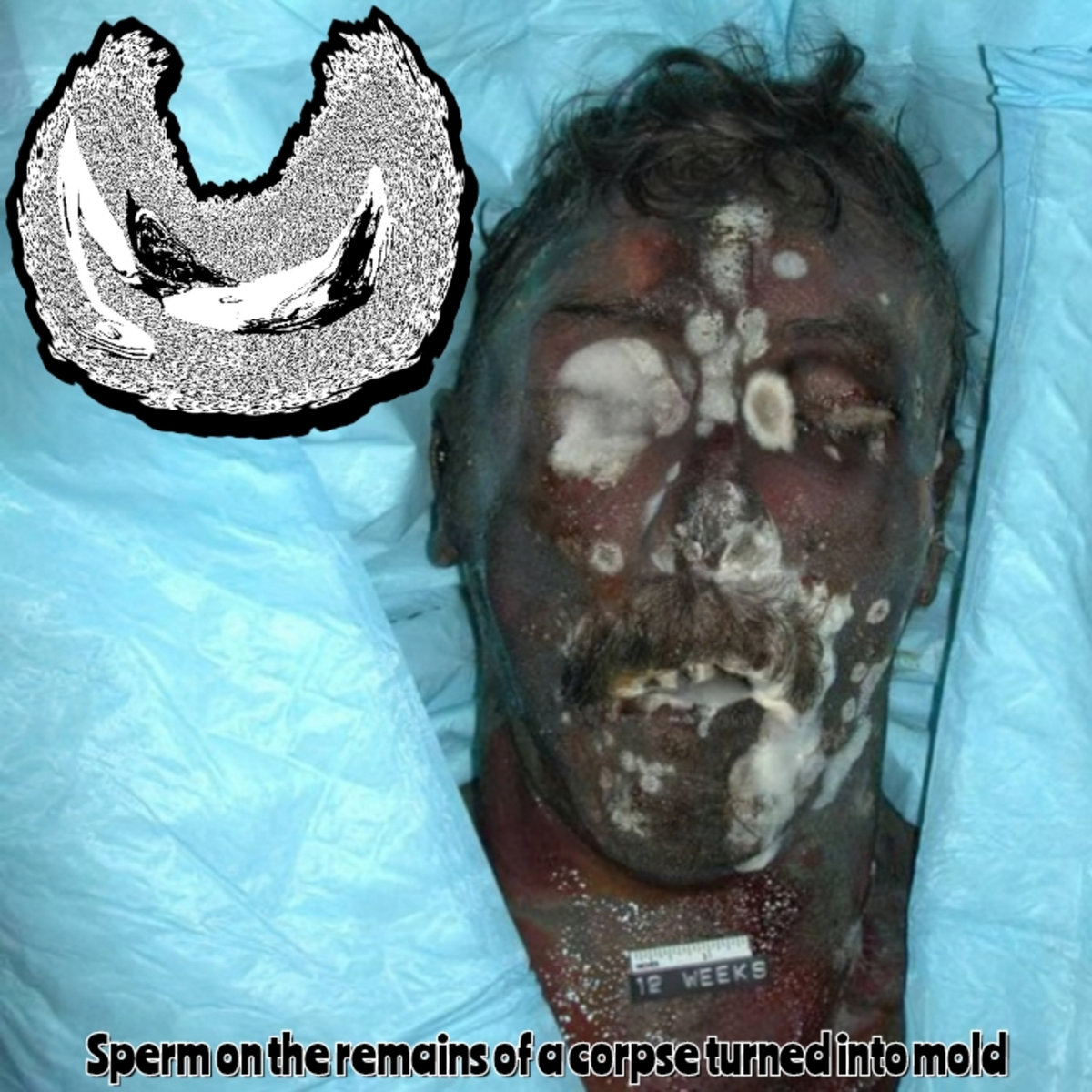 Sperm On The Remains Of A Corpse Turned Into Mold | UxCxRxAxAxSxTx ...