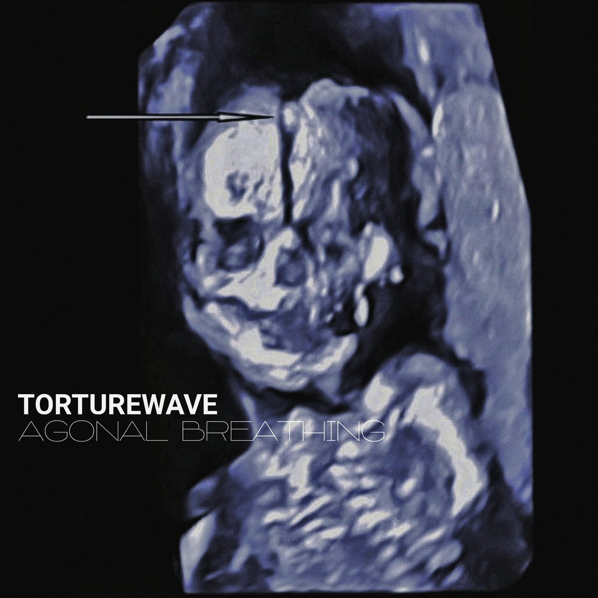 Agonal Breathing | TORTUREWAVE | Torturewave