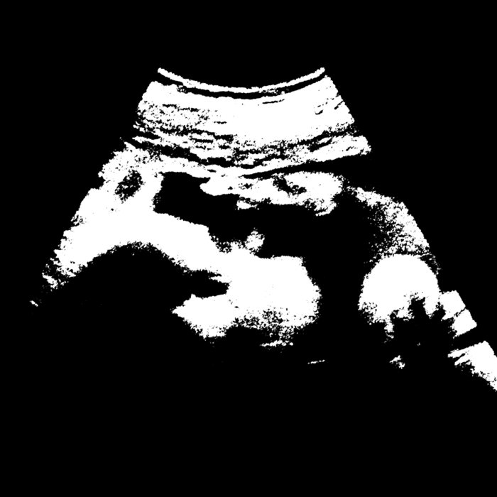 melded through bone | through a body