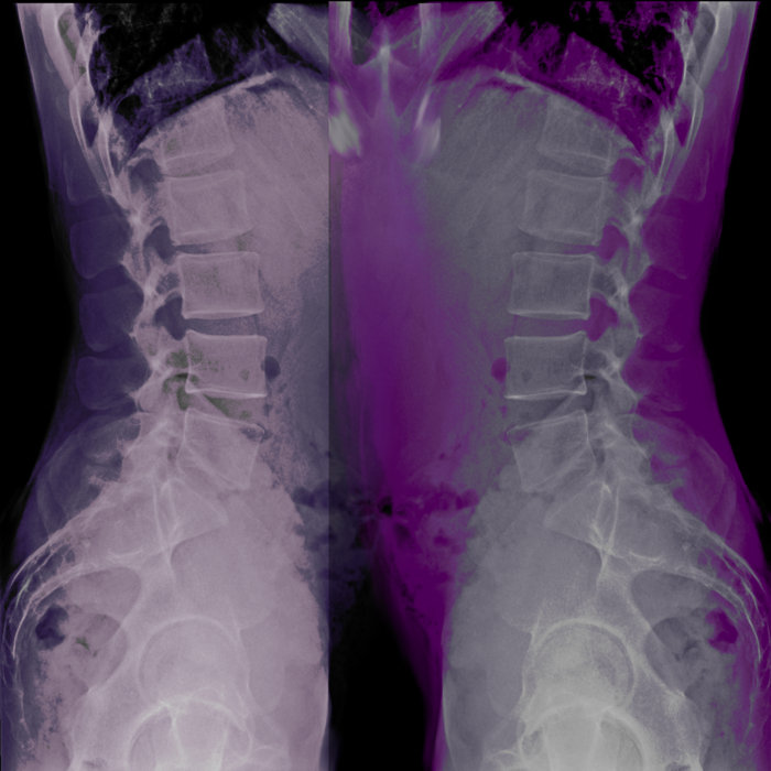fra//cture | Lav Andula