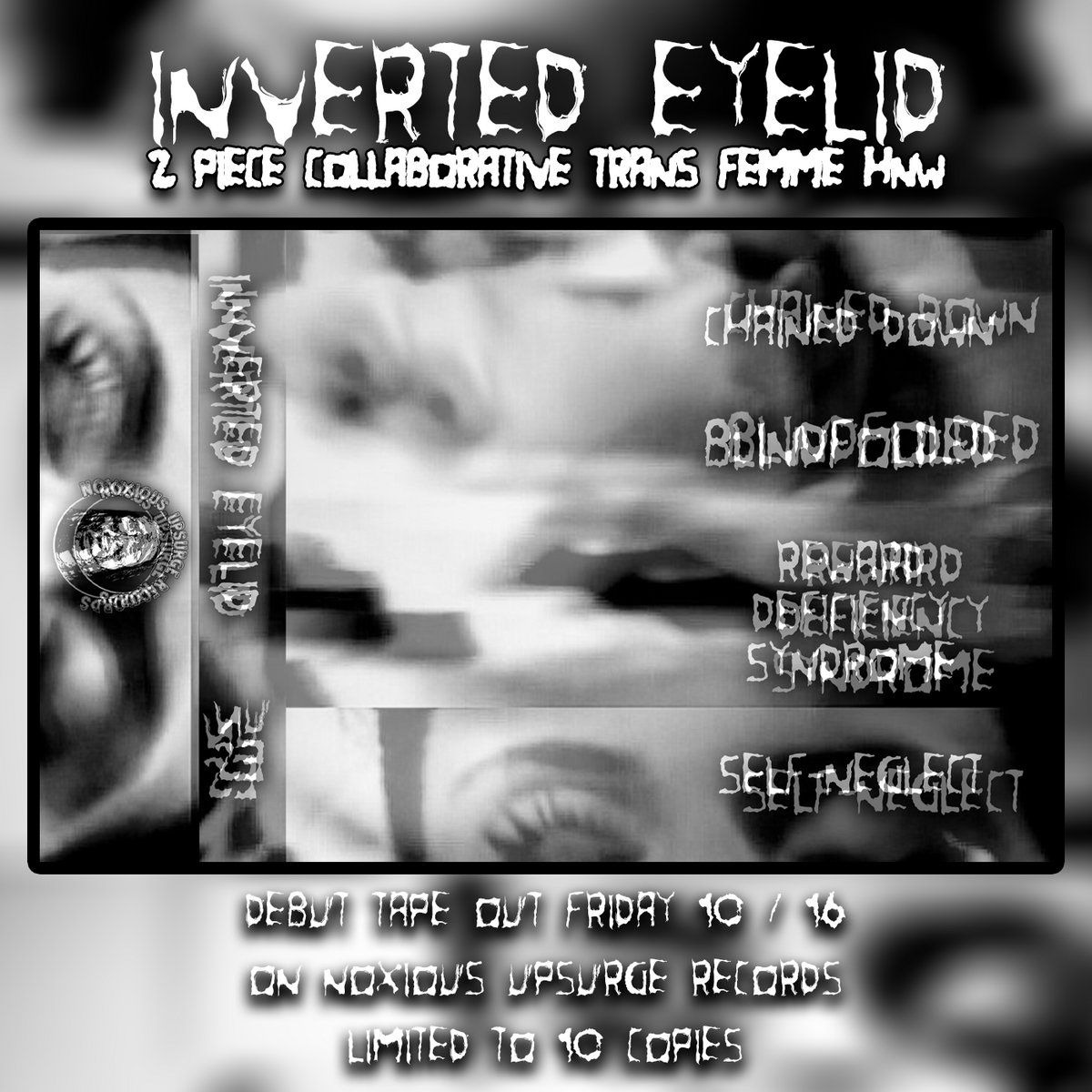 Inverted Eyelid Demos | Inverted Eyelid | Noxious Upsurge