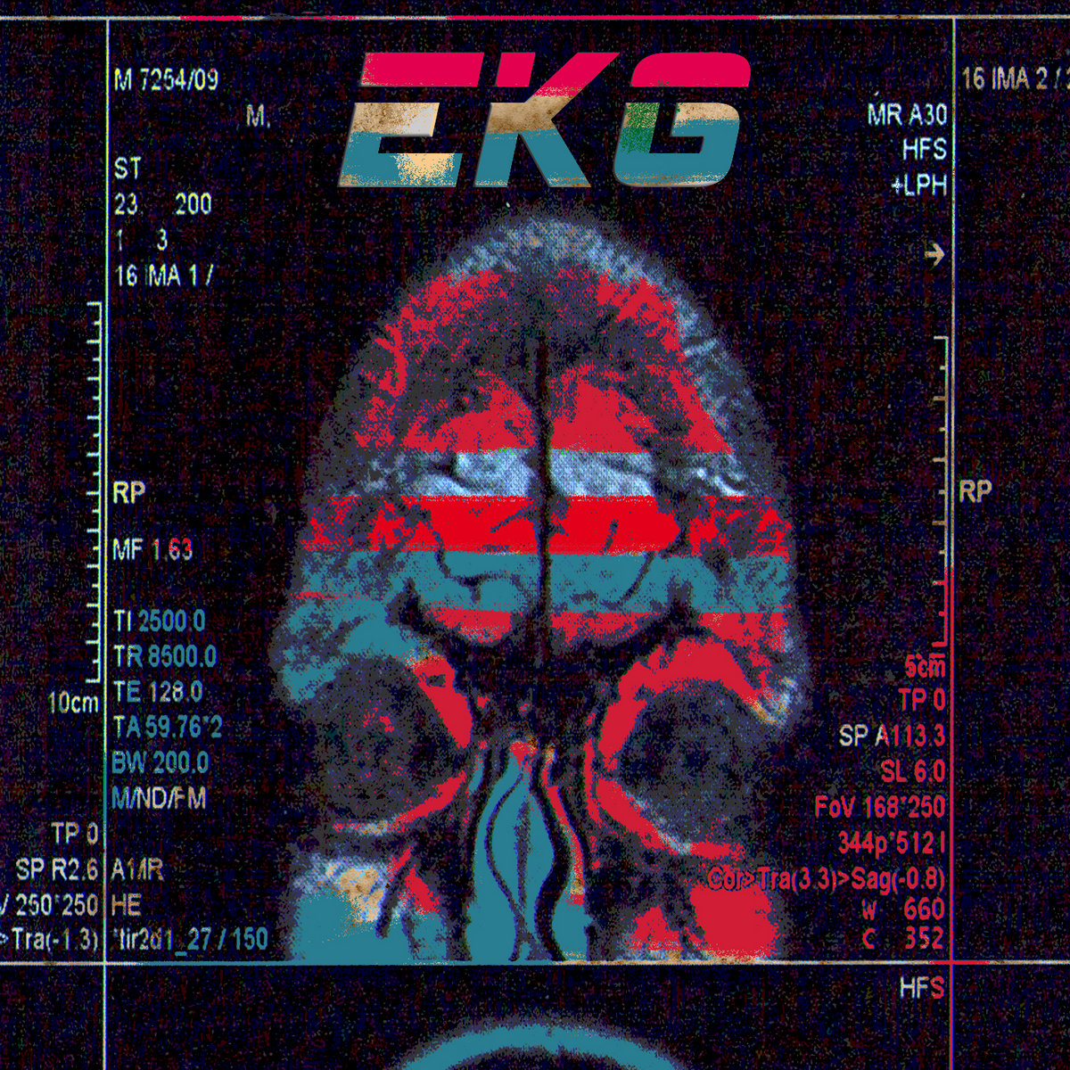 EKG | EKG (Lou Cypher, Adam Agon & Plu6-Mi9us) | Lou Cypher