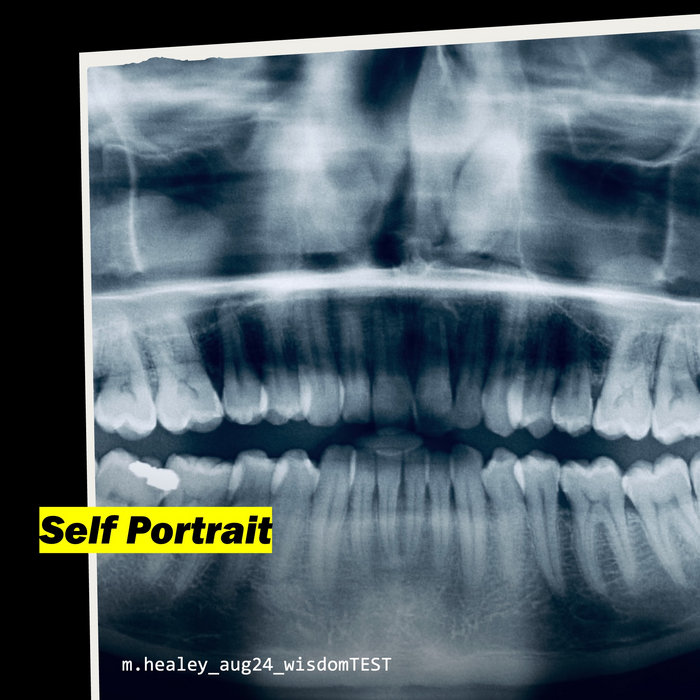 Self Portrait | Matthew Healey