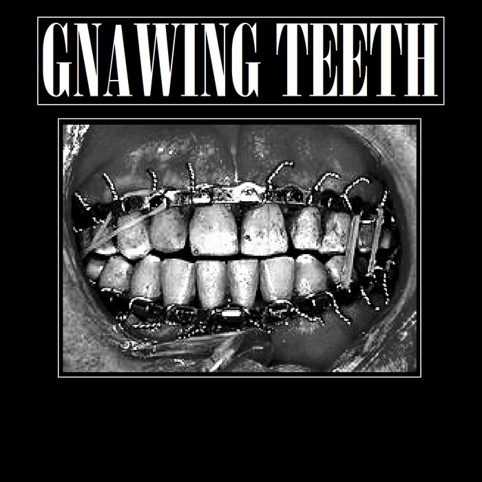 VII:VIOLENT ISOLATION Pt. 2 | GNAWING TEETH | AUDIBLE MASTICATION RECORDS