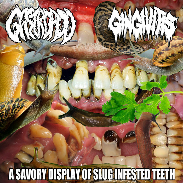 A Savory Display Of Slug Infested Teeth | GINGIVITIS / GASTROPOD ...