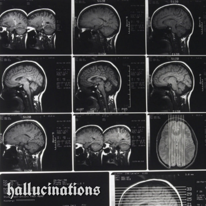 hallucinations | hallucinations | 𝗘𝗥𝗬𝗧𝗛𝗥𝗢𝗟𝗘𝗨𝗞𝗢𝗣𝗟𝗔𝗞𝗜𝗔 𝗥𝗘𝗖𝗢𝗥𝗗𝗦