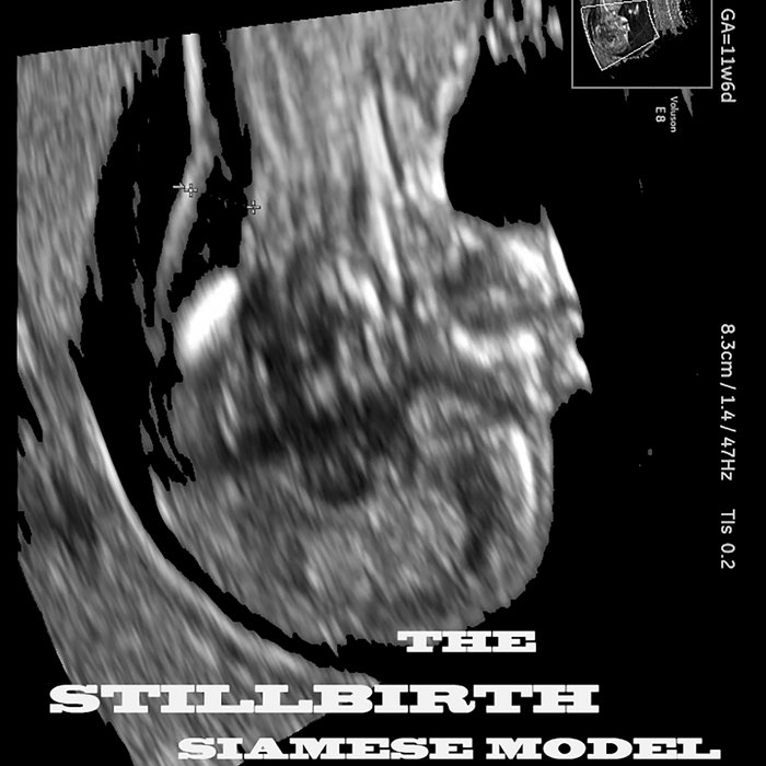 Stillbirth | The Siamese Model | Richard Ramirez