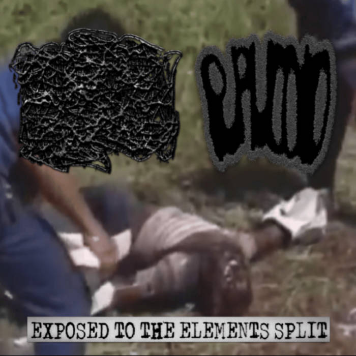 Split with Puruloid | Dermatofibrosarcoma Protuberans, Puruloid ...