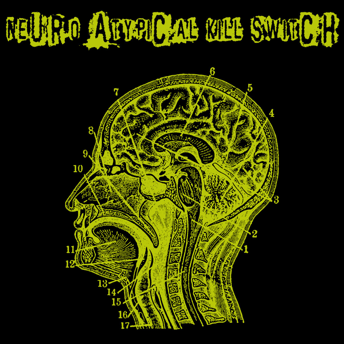 (Don't) Live, (Don't) Laugh, Only Lobotomy | Neuro Atypical Kill Switch