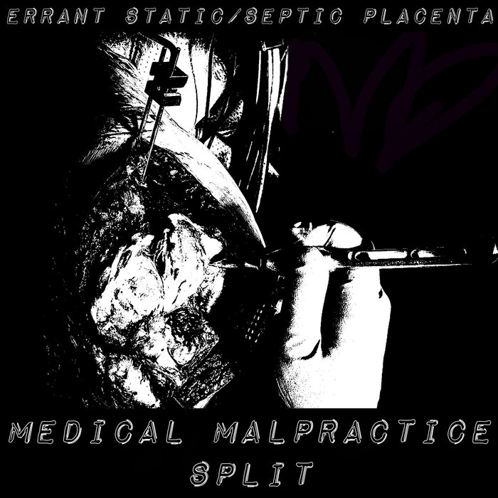Medical Malpractice Split | Errant Static / Septic Placenta | Errant Static