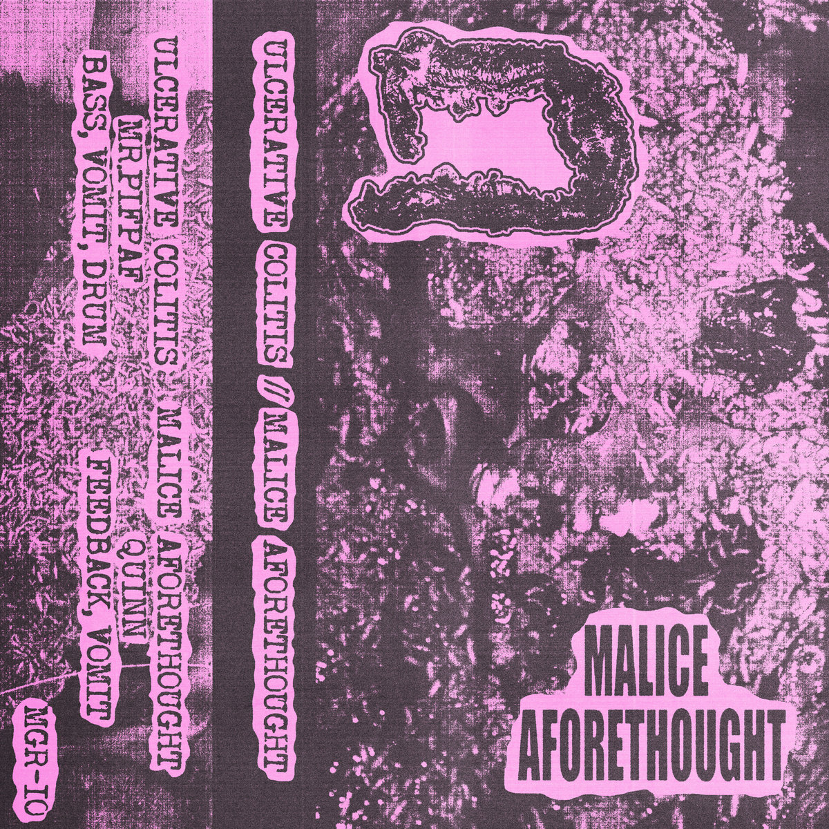 Ulcerative Colitis // Malice Aforethought | Ulcerative Colitis ...