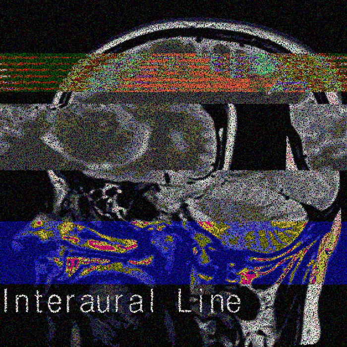 Interaural Line | Interaural Line