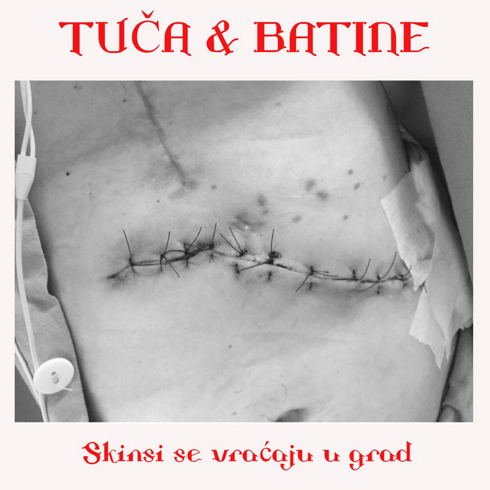 Skinsi se vraćaju u grad | TUČA & BATINE