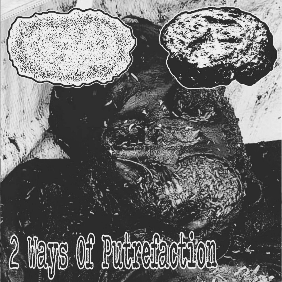 2 Ways Of Putrefaction | DxTx, HYDROENCEPHALOCYSTCELE | Forced Trauma ...