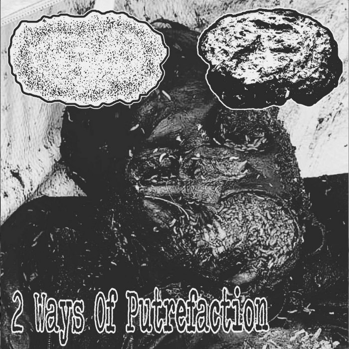 2 Ways Of Putrefaction | DxTx, HYDROENCEPHALOCYSTCELE | Forced Trauma ...
