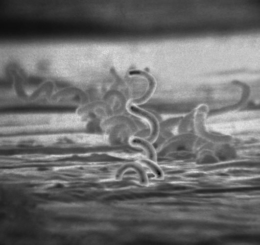 Syphilis (+Bongface) | arthur maslo