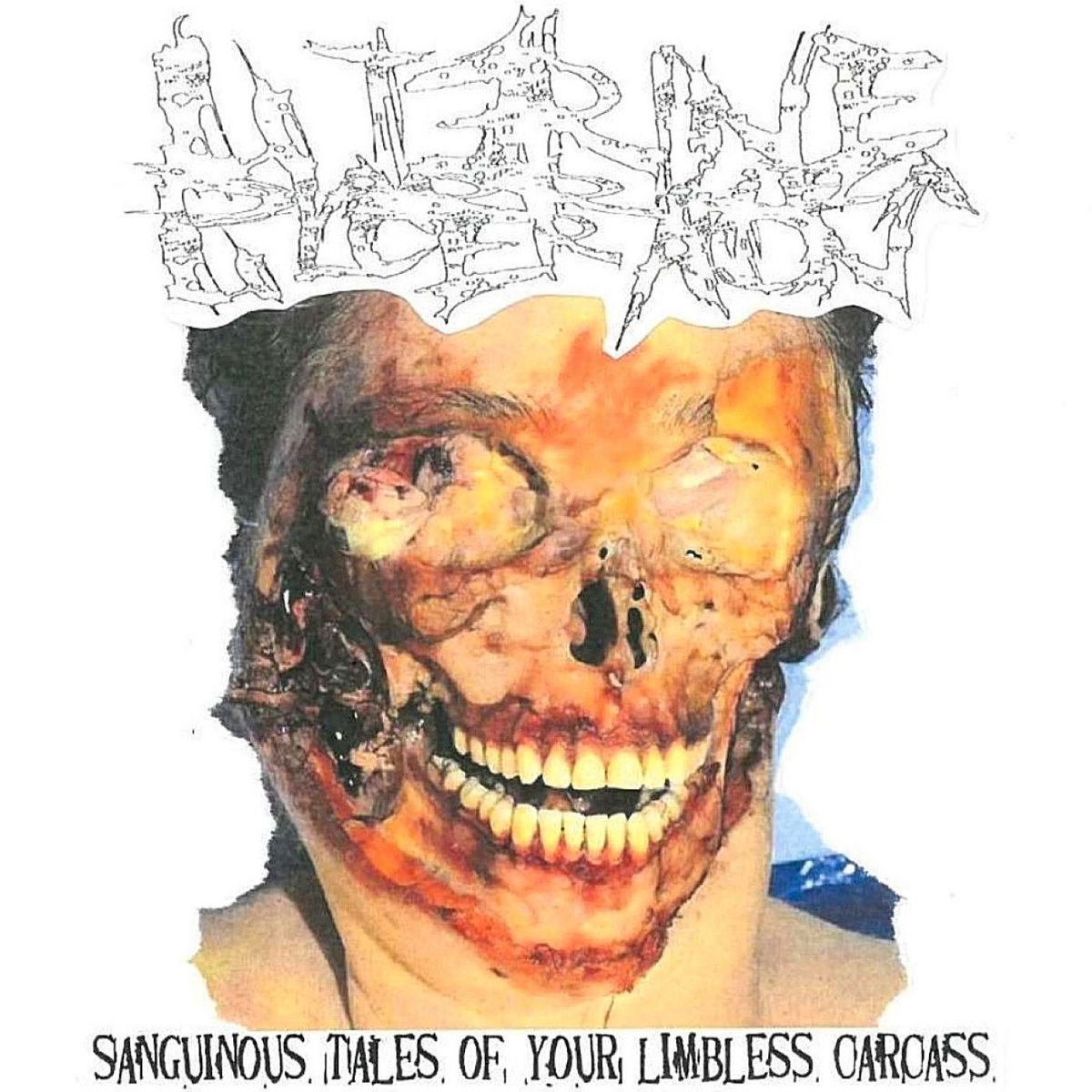 UTERINE DIARRHEA ULCERATION-SANGUINOUS TALES OF YOUR LIMBLESS CARCASS ...