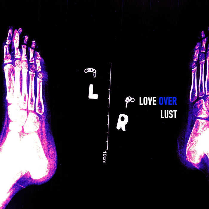 L|R | Love Over Lust