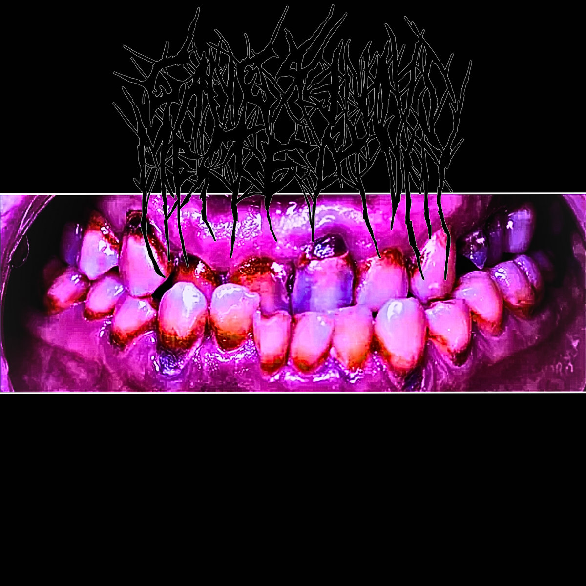 Meth Stained and Blood Drained | Gangrenous Meatectomy | Gouged Eyes ...