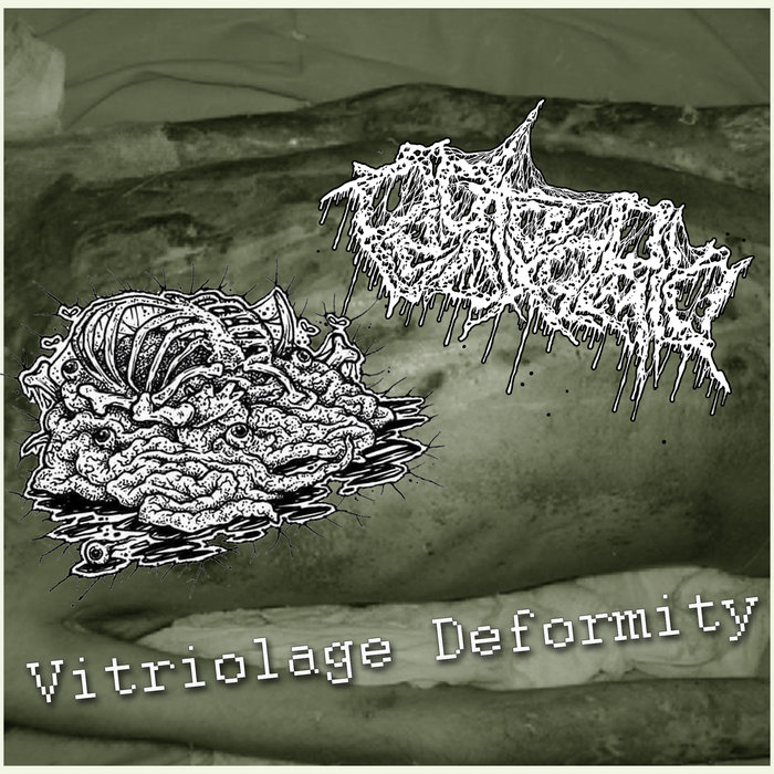 "Vitriolage Deformity" split w.Botched Anastomosis J-Pouch | Endotoxaemia