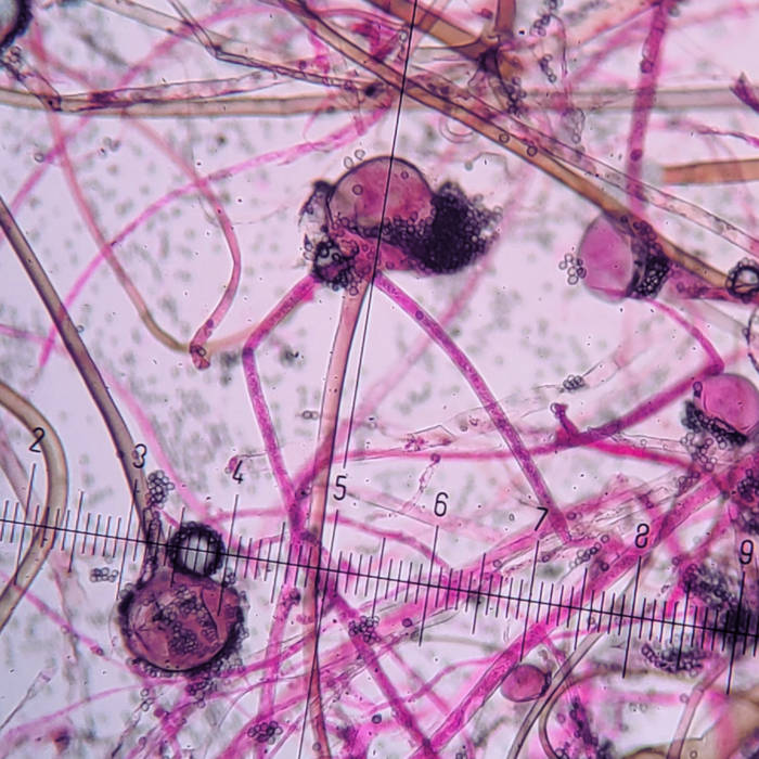 Rhizopus Stolonifer Under Microscope