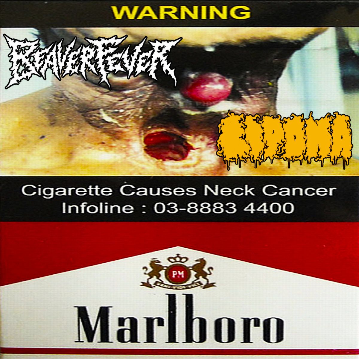 Dr. Manos Karagiannis Expert Surgeon of Lung Pathology | Lipoma