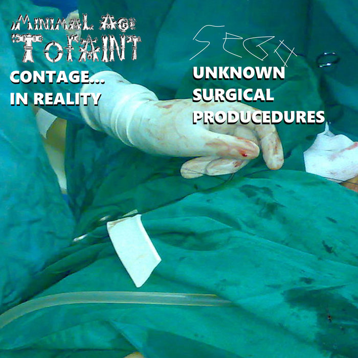 Contage... In Reality - Unknown Surgical Procedures | Minimum Age to ...