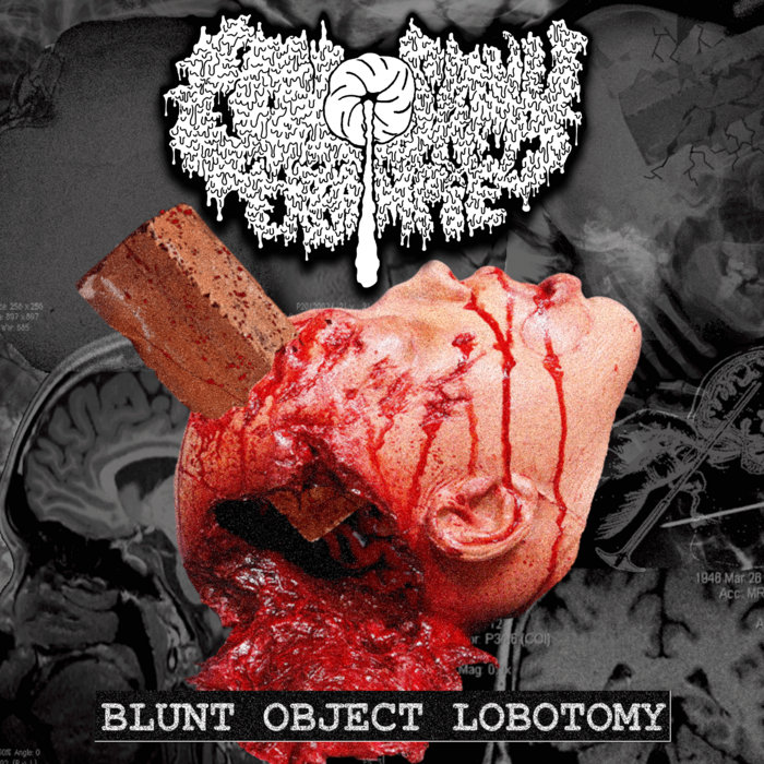 Blunt Object Lobotomy | Colostomy Creampie