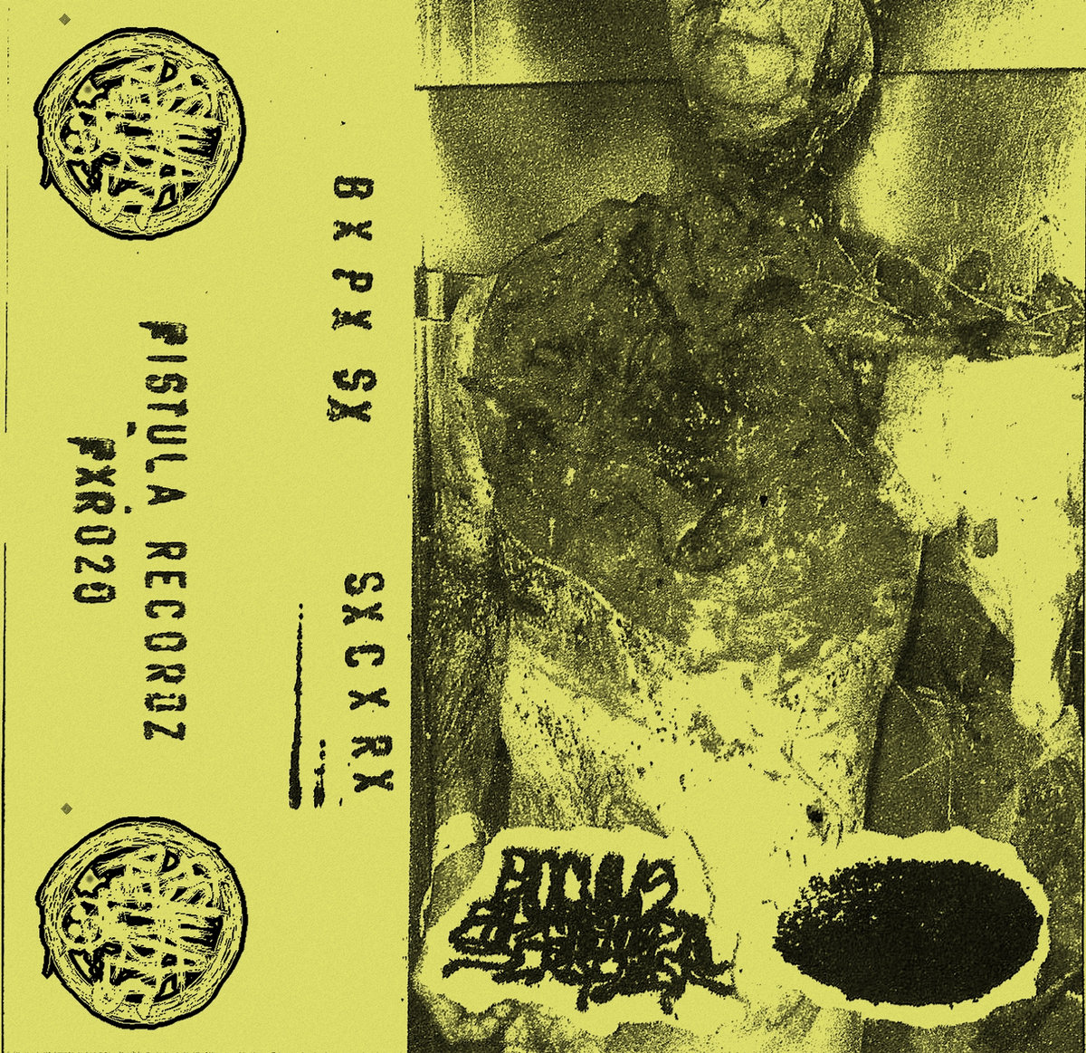 Split | Bioculus Phlyctaenulosial Scrofulosa/ Stercoraceous Copromesis ...