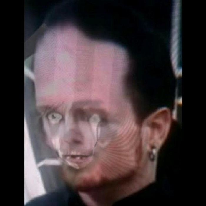 Mental Midgets | Dwarf Pit