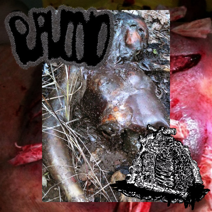 Atherosclerosis / Puruloid Split | Puruloid, Atherosclerosis | Puruloid