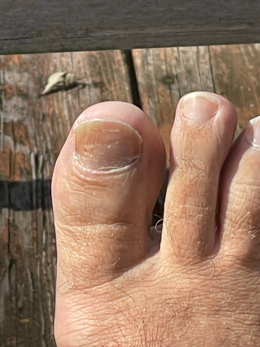 Ptomaine Pompatus | Alice DeVille's Hard Drivers