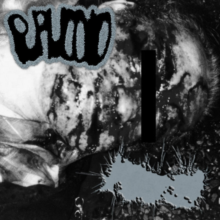 Puruloid/Rancid Fecal Sludge | Puruloid and Rancid Fecal Sludge ...