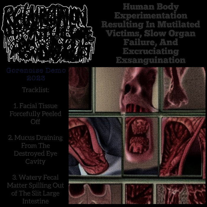Human Body Experimentation Resulting In Mutilated Victims, Slow Organ ...