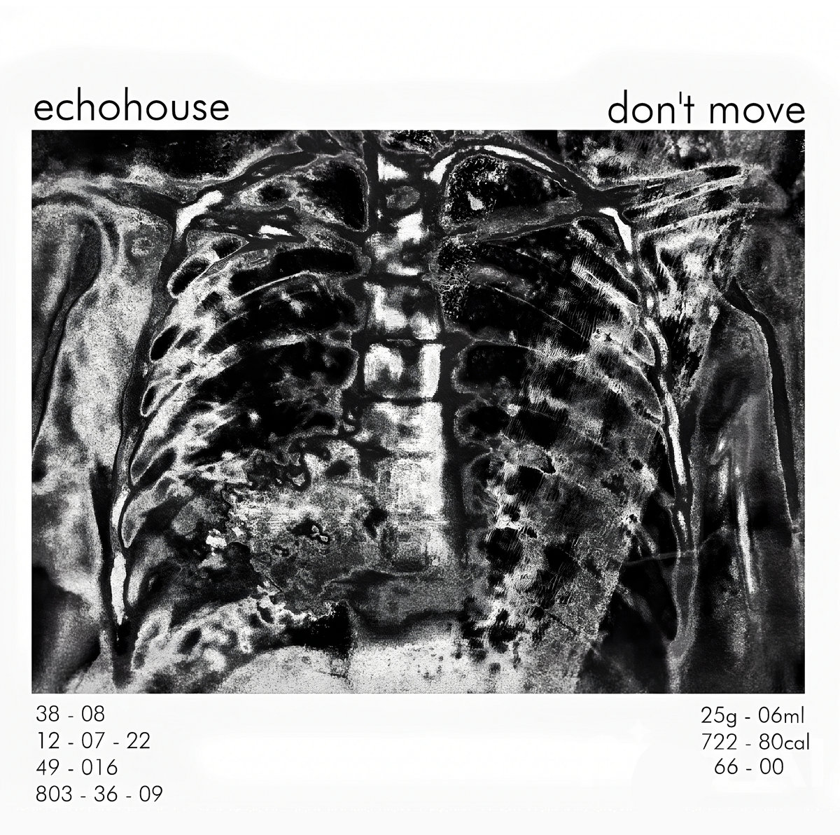Don't Move | EchoHouse