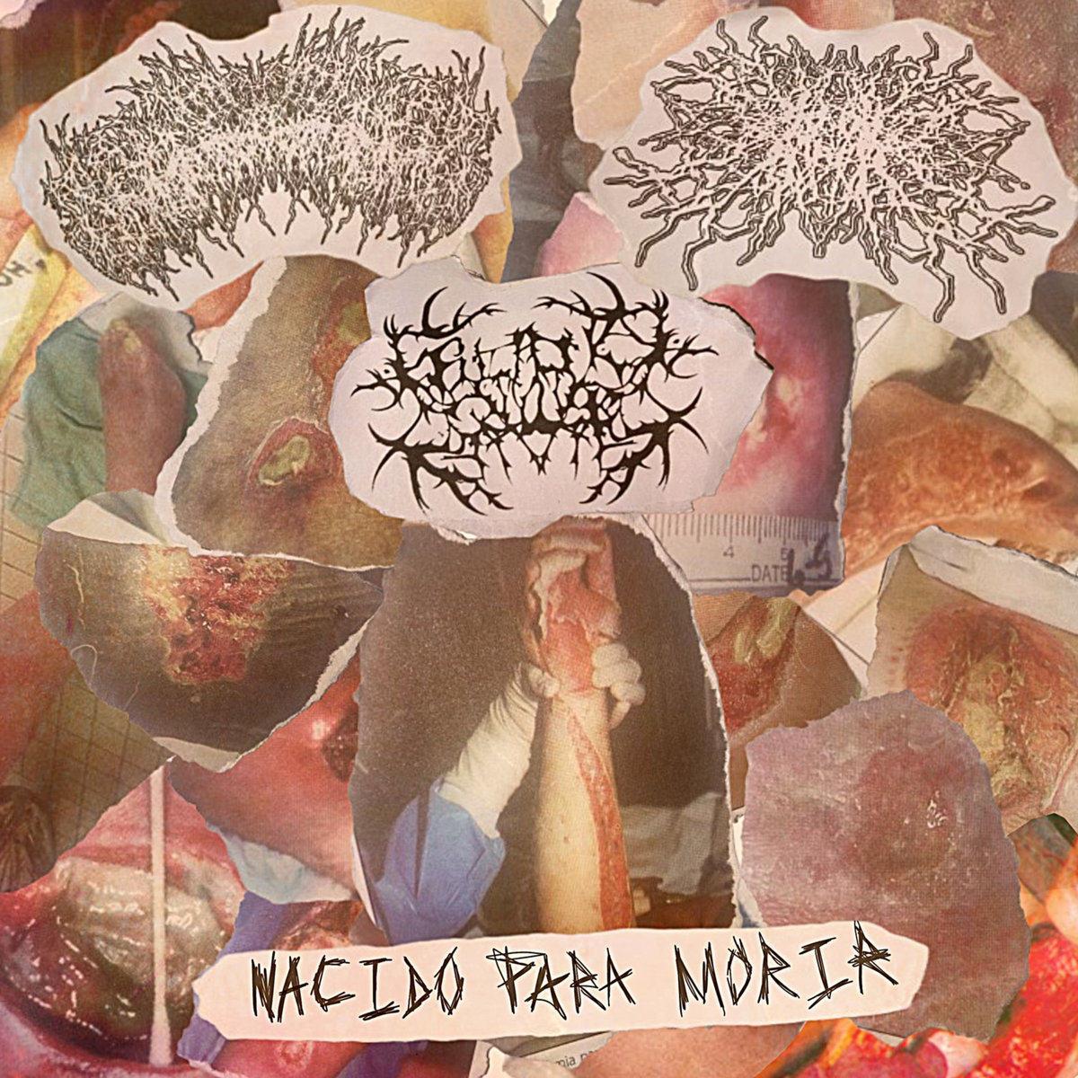 Nacido Para Morir - 3 WAY SPLIT - FxM Side | Fetal Malformation