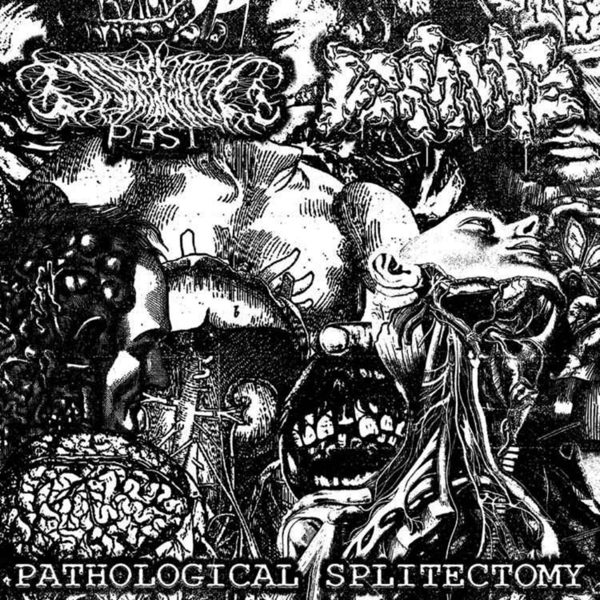 PATHOLOGICAL SPLITECTOMY (COMPRESSED PEST) | Compressed Pest, Verminate ...