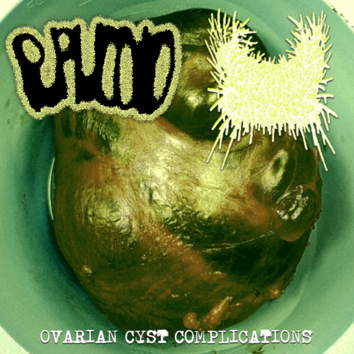 OVARIAN CYST COMPLICATIONS (split with puruloid) | Voracious Carcass ...