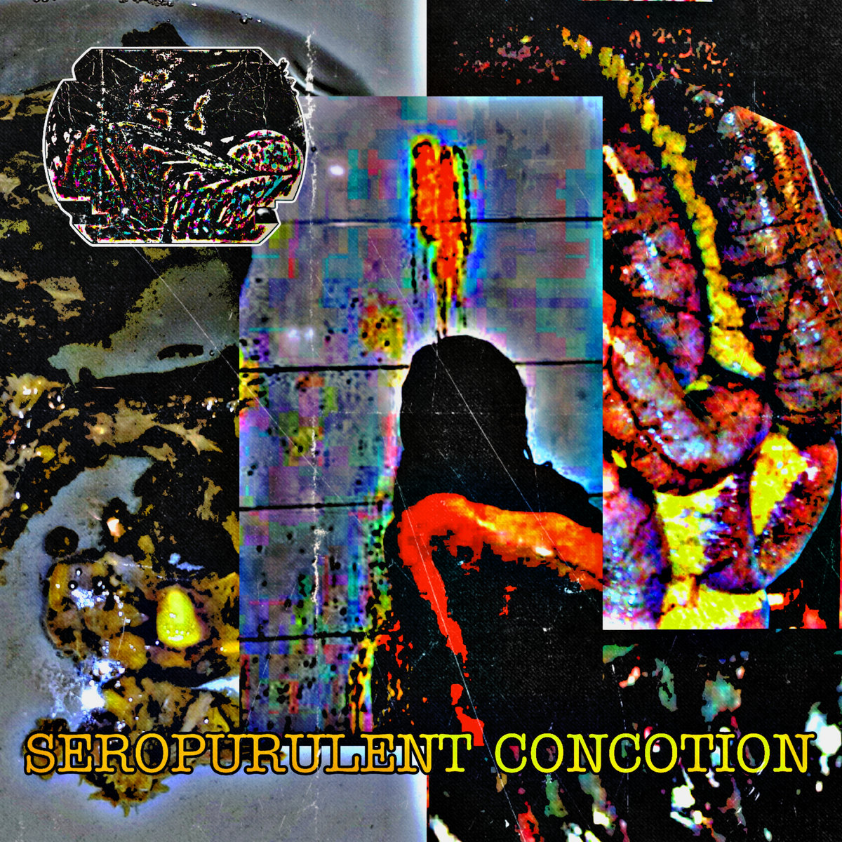 Seropurulent Concoction | PURULENT RECTAL MUCUS | Unauthorized Surgeons ...