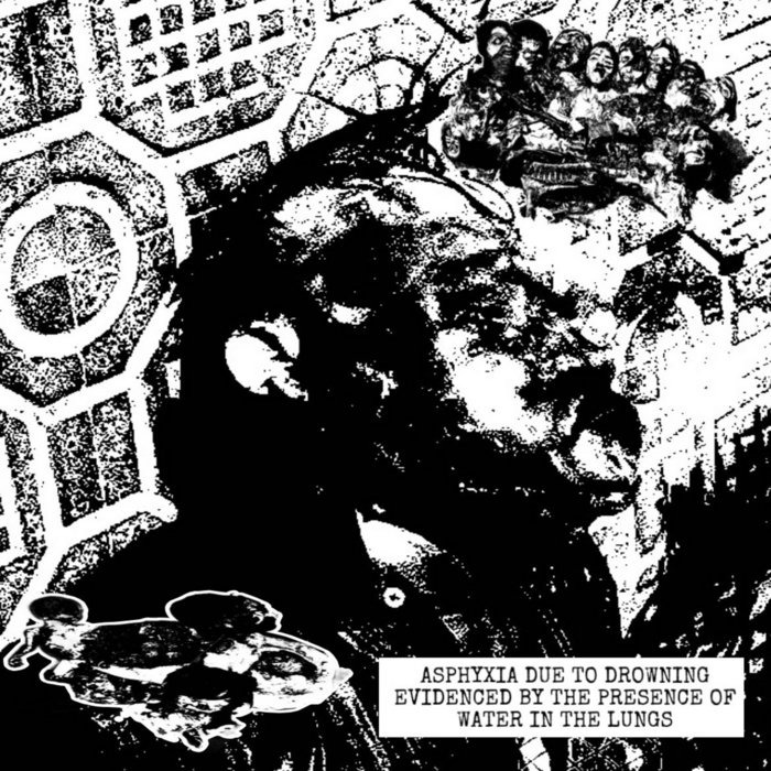 Asphyxia Due to Drowning Evidence by the Presence of Water in the Lungs ...