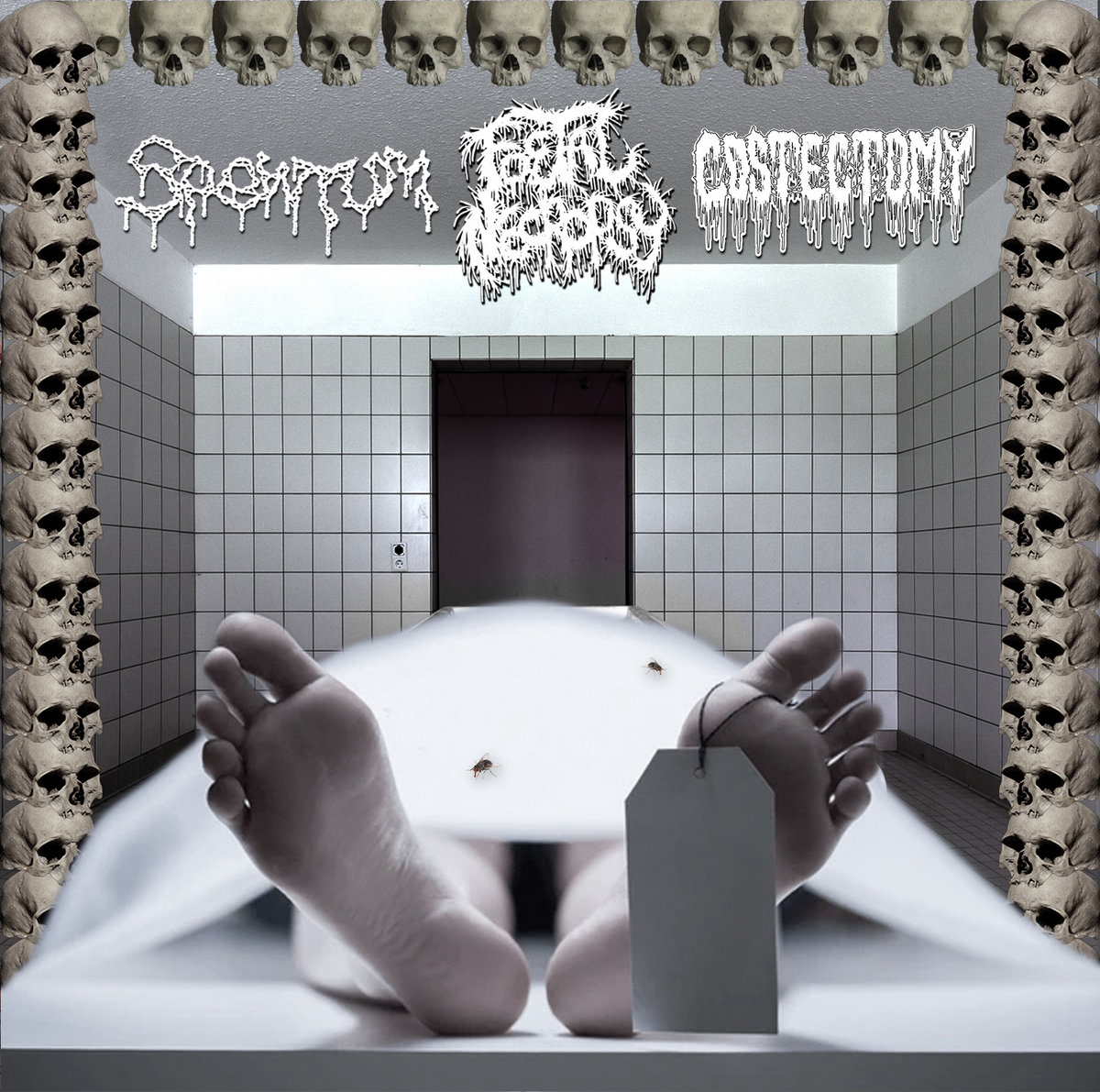 SPLIT WITH FOETAL NECROPSY AND COSTECTOMY | SPEWTUM
