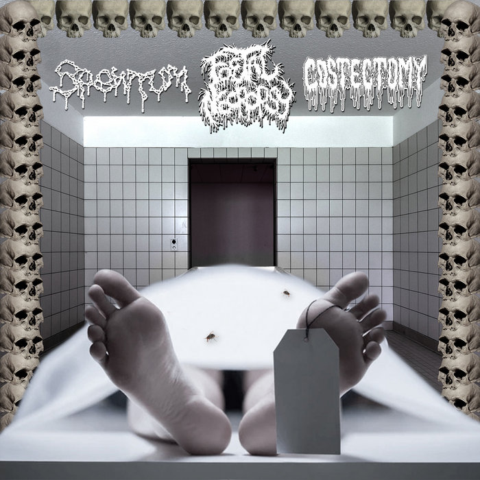 SPLIT WITH FOETAL NECROPSY AND COSTECTOMY | SPEWTUM