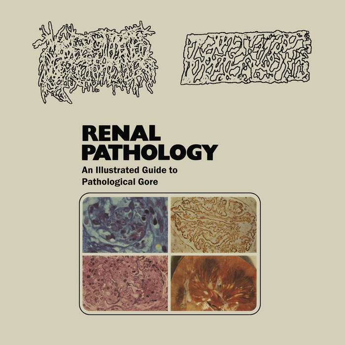 Renal Pathology: An Illustrated Guide to Pathological Gore (Split w ...